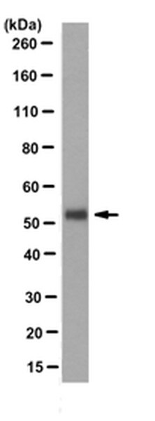 Anti-Cyp7a1 Antibody, clone 15B9.1 | MABD42